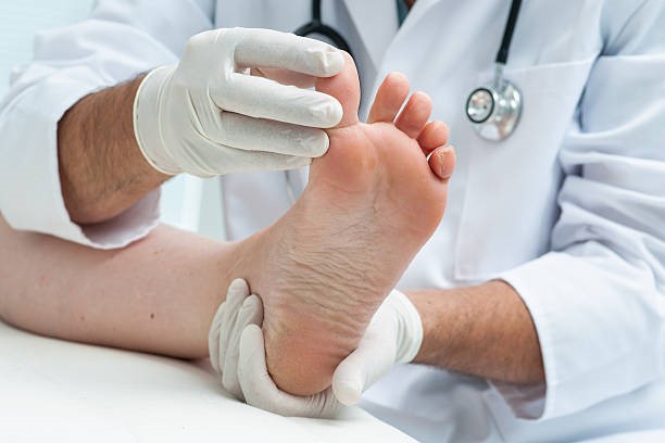 Claw toe causes, treatment and prevention - News Anyway